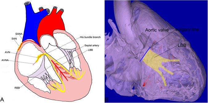 Locating the Human Cardiac Conduction System Using a 3D Model of Its ...