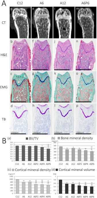 Development of a novel chronic kidney disease mouse model to evaluate ...