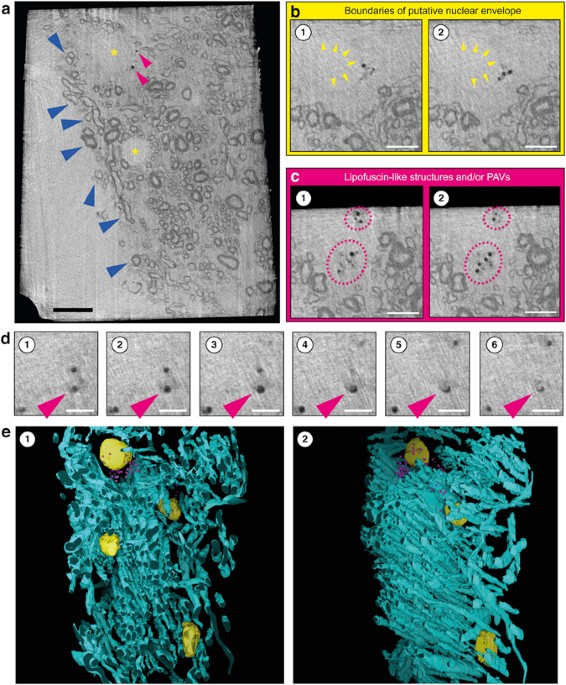 Three-Dimensional Imaging of Biological Tissue by Cryo X-Ray ...