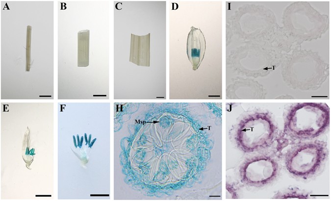 An atypical strictosidine synthase, OsSTRL2, plays key roles in anther ...
