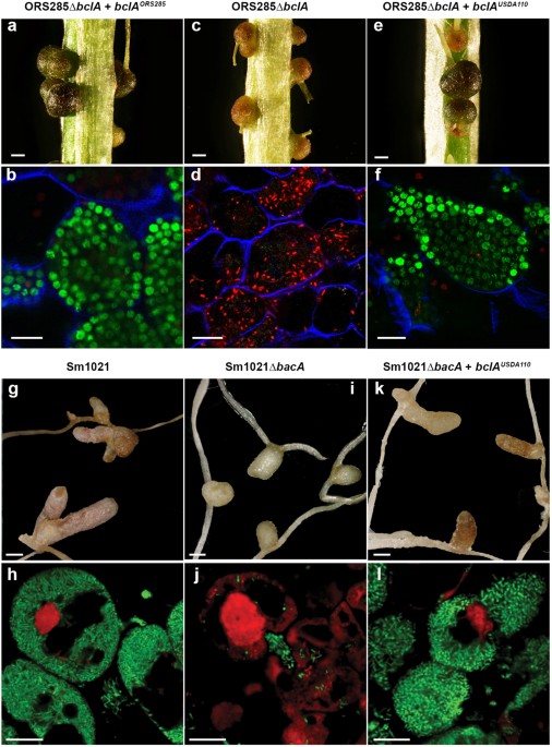 Integrated roles of BclA and DD-carboxypeptidase 1 in Bradyrhizobium differentiation within NCR ...
