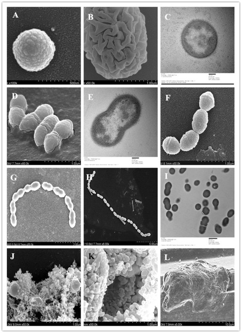 Three novel structural phenomena in the cellular ontogeny of Oenococcus ...
