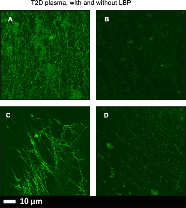 Lipopolysaccharide-binding protein (LBP) reverses the amyloid state of ...
