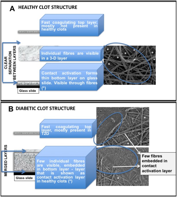 Lipopolysaccharide-binding protein (LBP) reverses the amyloid state of ...