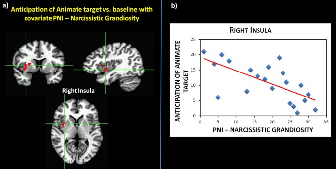 How spontaneous brain activity and narcissistic features shape social ...