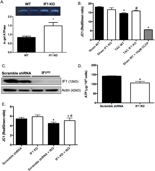 Knockout of the ATPase inhibitory factor 1 protects the heart from ...