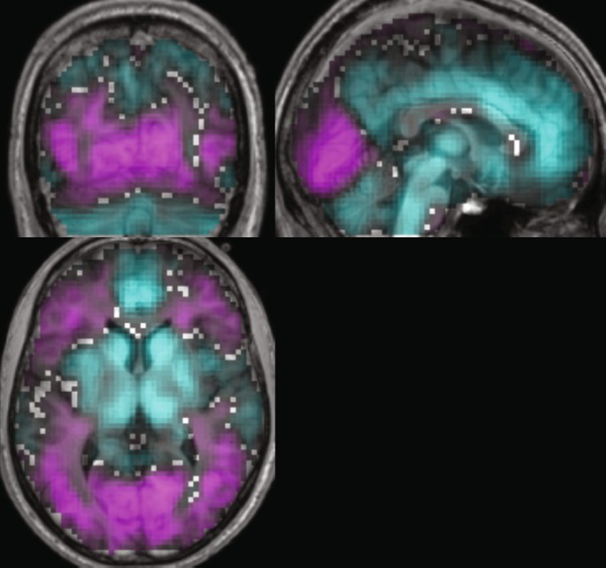 In human non-REM sleep, more slow-wave activity leads to less blood ...