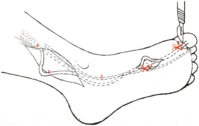 Anatomical Study of the Neurovascular in Flexor Hallucis Longus Tendon ...