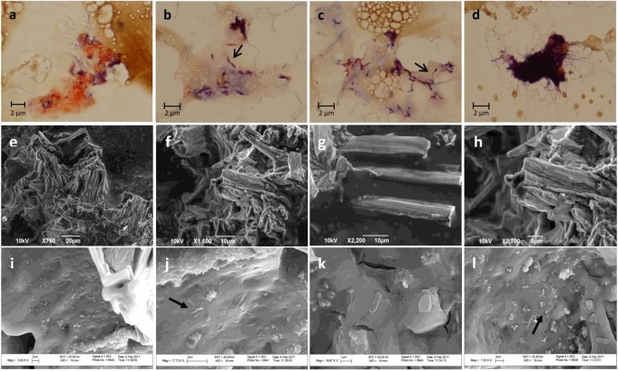 Gelatinizing oil in water and its removal via bacteria inhabiting the ...