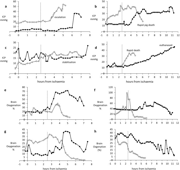 A clinical-scale BioArtificial Liver, developed for GMP, improved ...
