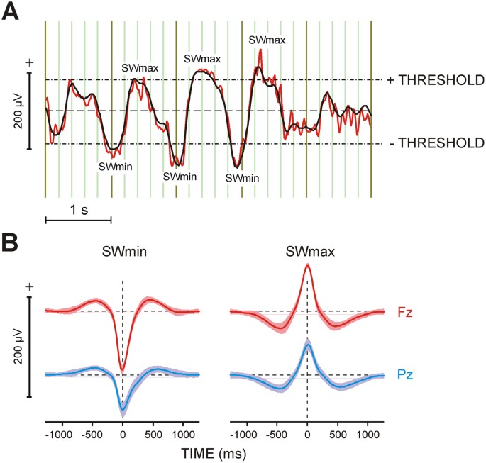 Dynamic coupling between slow waves and sleep spindles during slow wave sleep in humans is ...