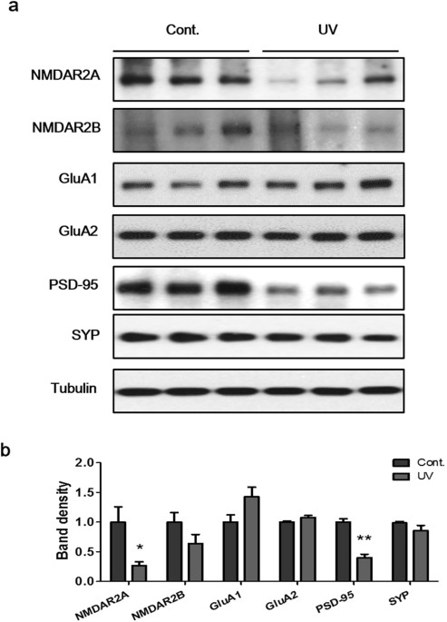 UV irradiation to mouse skin decreases hippocampal neurogenesis and ...