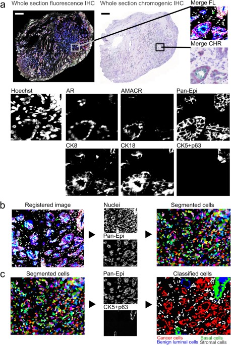 Systems pathology by multiplexed immunohistochemistry and whole-slide ...