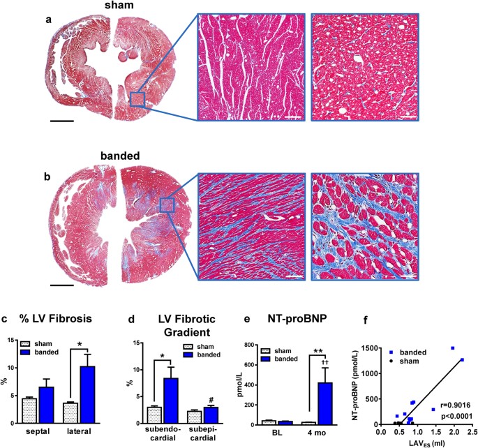 A Feline HFpEF Model with Pulmonary Hypertension and Compromised ...