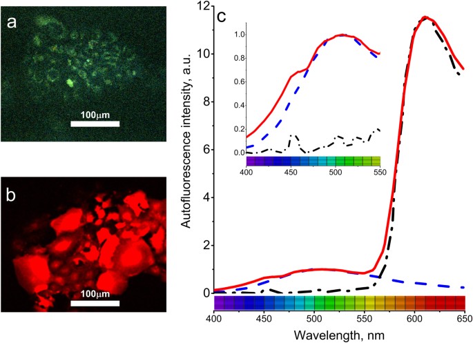 Health state dependent multiphoton induced autofluorescence in human 3D ...