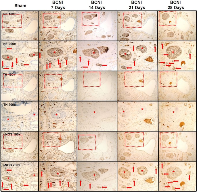nNOS-positive minor-branches of the dorsal penile nerves is associated ...
