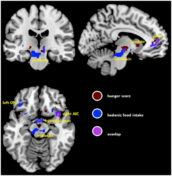 The motilin agonist erythromycin increases hunger by modulating ...