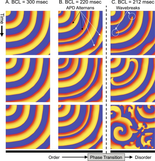 Locating Order-Disorder Phase Transition in a Cardiac System ...