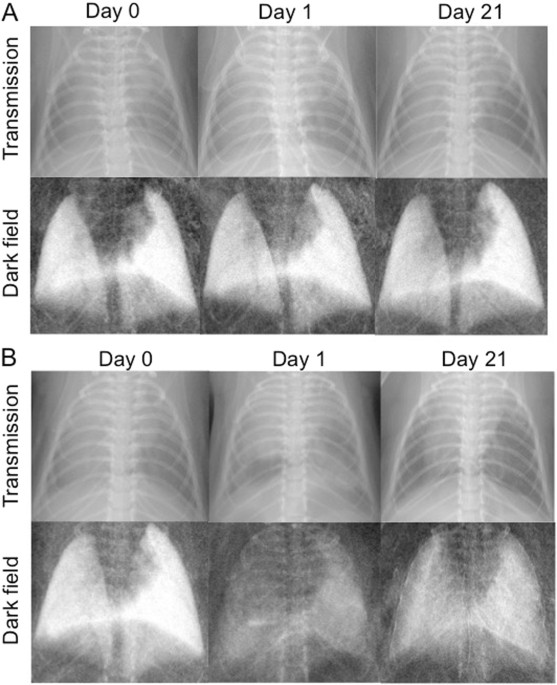 X-Ray Dark-field Imaging to Depict Acute Lung Inflammation in Mice ...