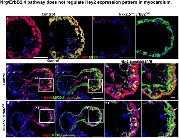 Notch signaling regulates Hey2 expression in a spatiotemporal dependent ...