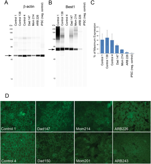 Mutant Best1 Expression and Impaired Phagocytosis in an iPSC Model of ...