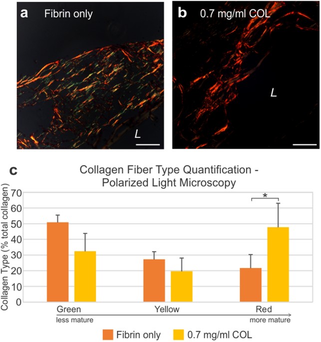 Self-assembled Collagen-Fibrin Hydrogel Reinforces Tissue Engineered ...