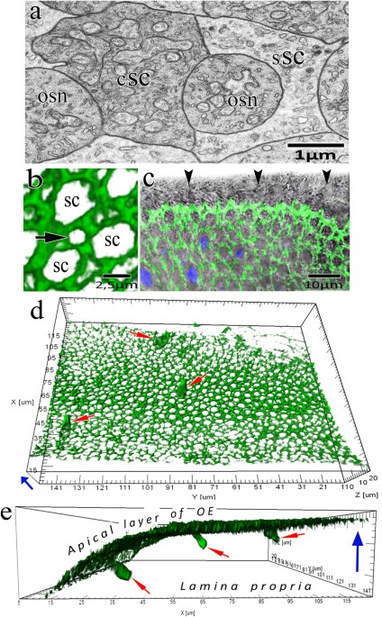 Rearrangement of Actin Microfilaments in the Development of Olfactory ...