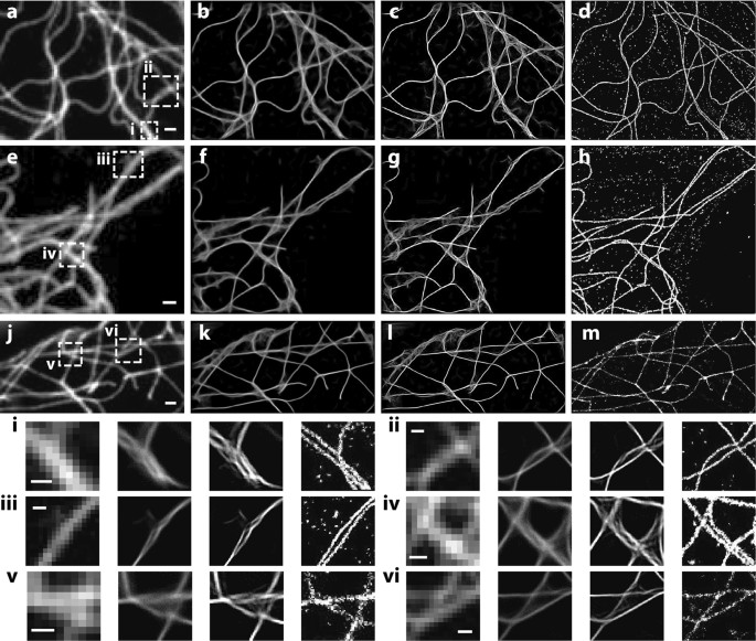 Example-Based Super-Resolution Fluorescence Microscopy | Scientific Reports