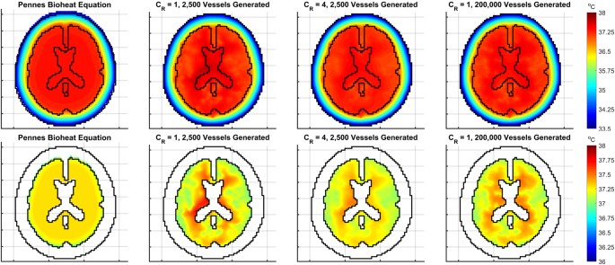 How does blood regulate cerebral temperatures during hypothermia ...