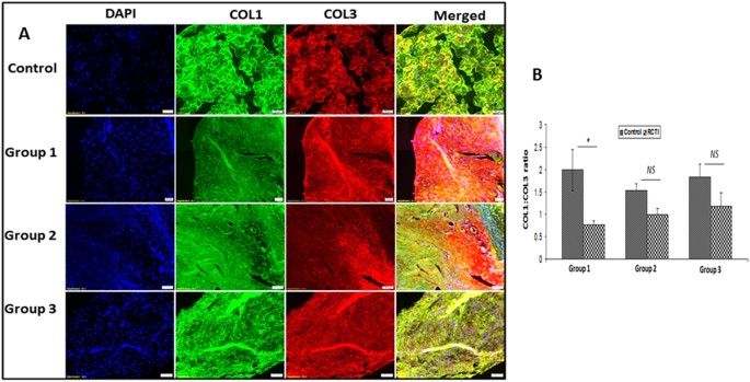 Association of Inflammatory Responses and ECM Disorganization with ...