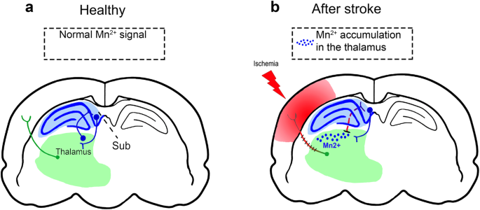 Sensorimotor stroke alters hippocampo-thalamic network activity ...