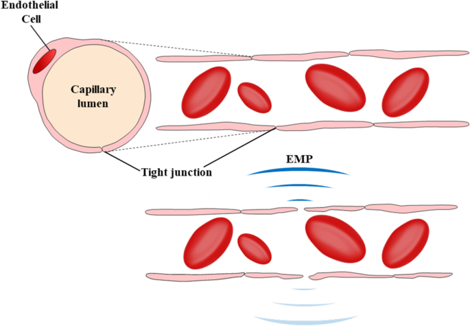 Effects of pulse parameters on the temperature distribution of a human ...