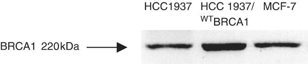 BRCA1 expression modulates chemosensitivity of BRCA1-defective HCC1937 ...