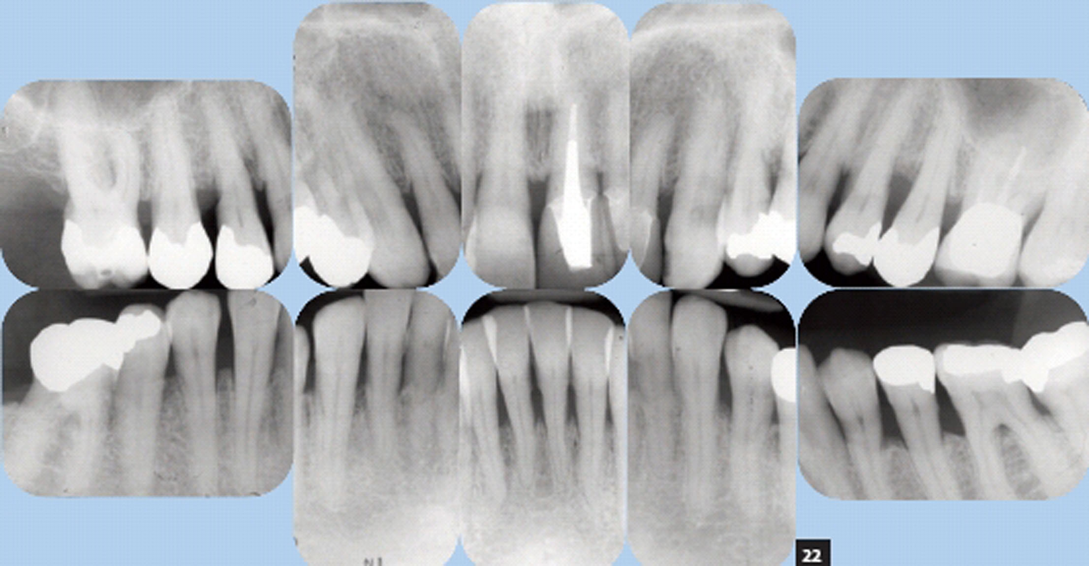 Vijftig keer aandacht voor het parodontium | SpringerLink