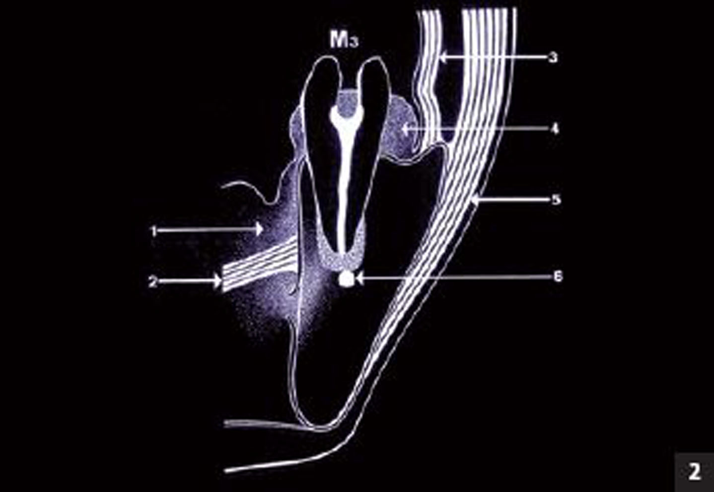 Dentogene loge-abcessen in het hoofd-halsgebied | SpringerLink
