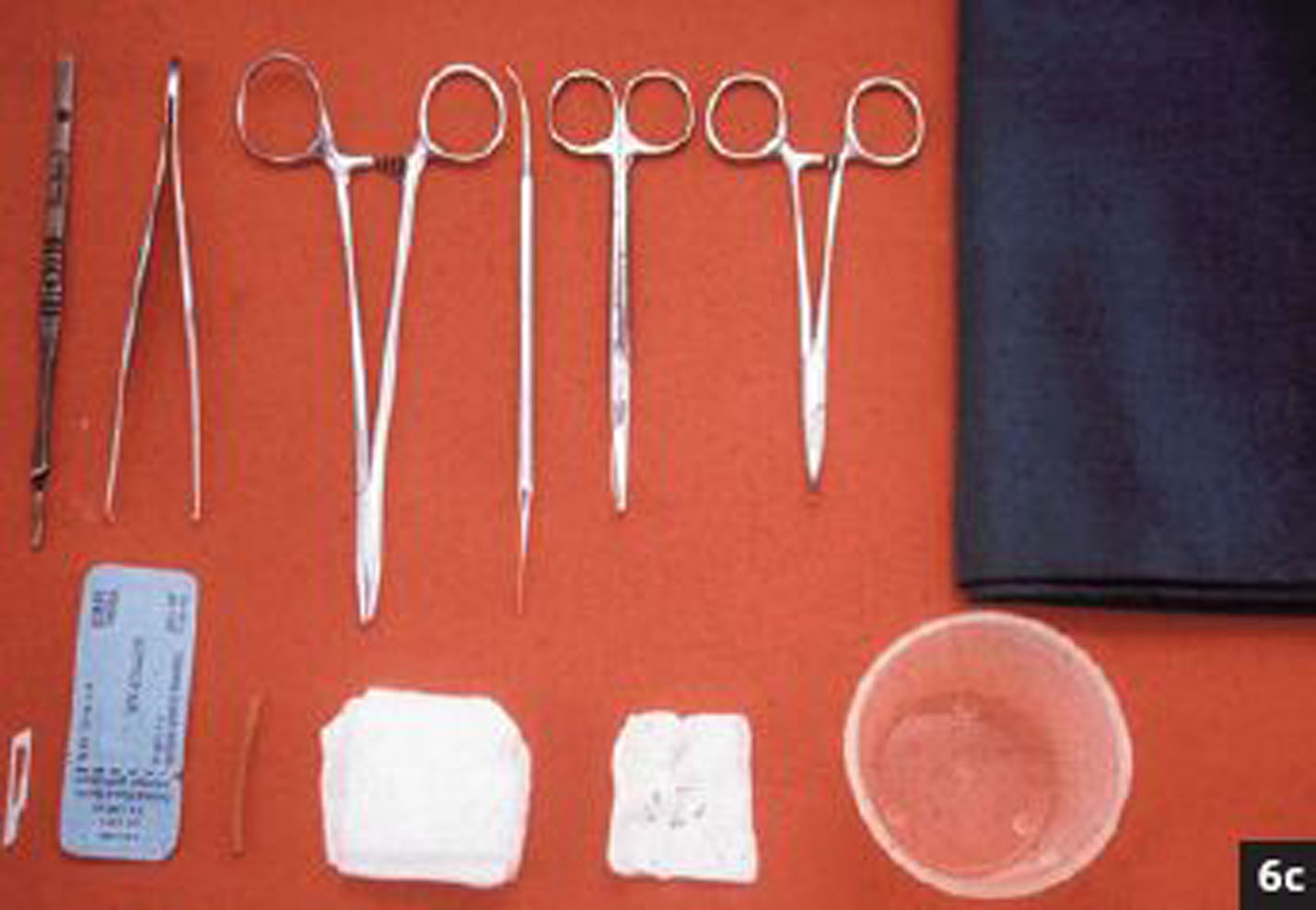 Dentogene loge-abcessen in het hoofd-halsgebied | SpringerLink