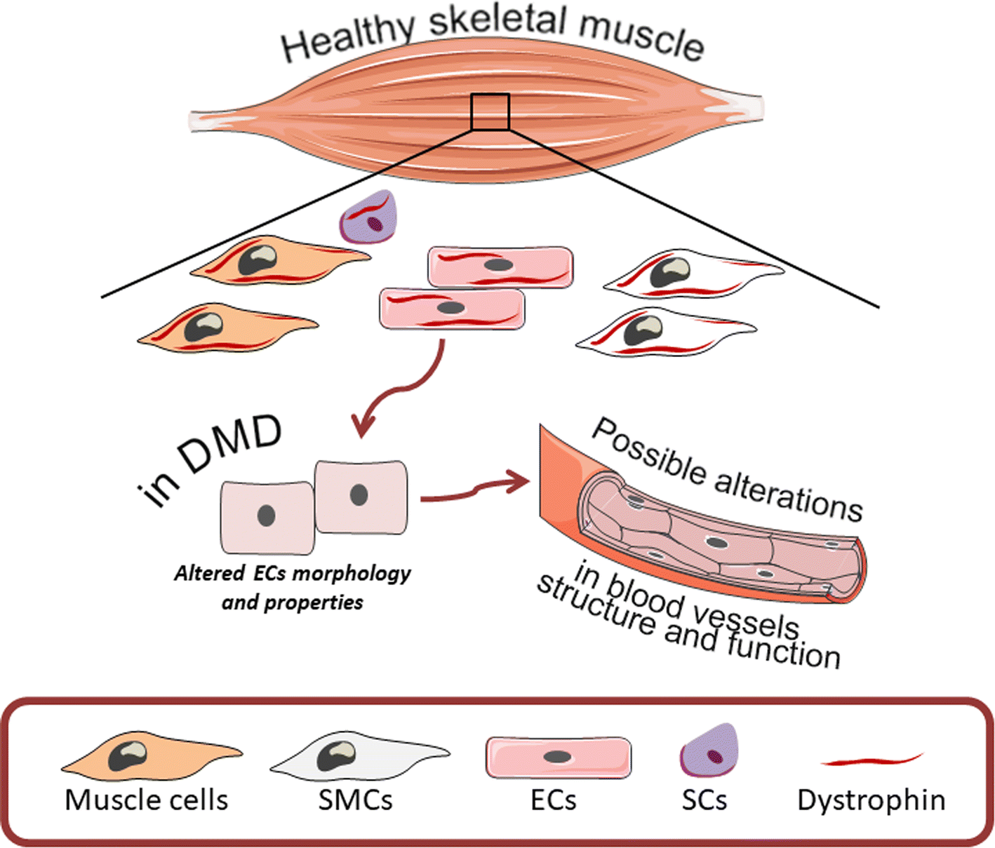 Targeting angiogenesis in Duchenne muscular dystrophy | SpringerLink
