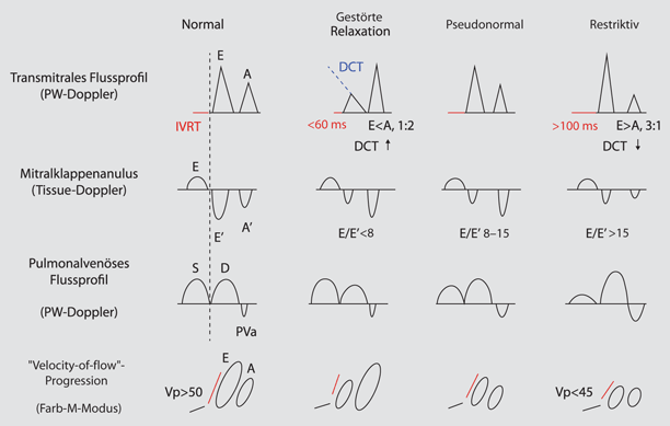 Diagnostik und Therapie der Herzinsuffizienz | SpringerLink