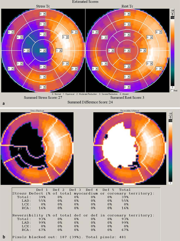 Diagnostik der koronaren Herzkrankheit | SpringerLink
