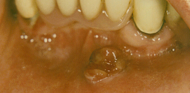 Herausforderung für Diagnostiker | SpringerLink