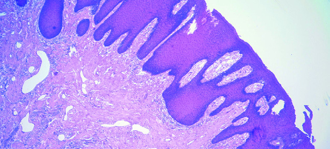 Herausforderung für Diagnostiker | SpringerLink