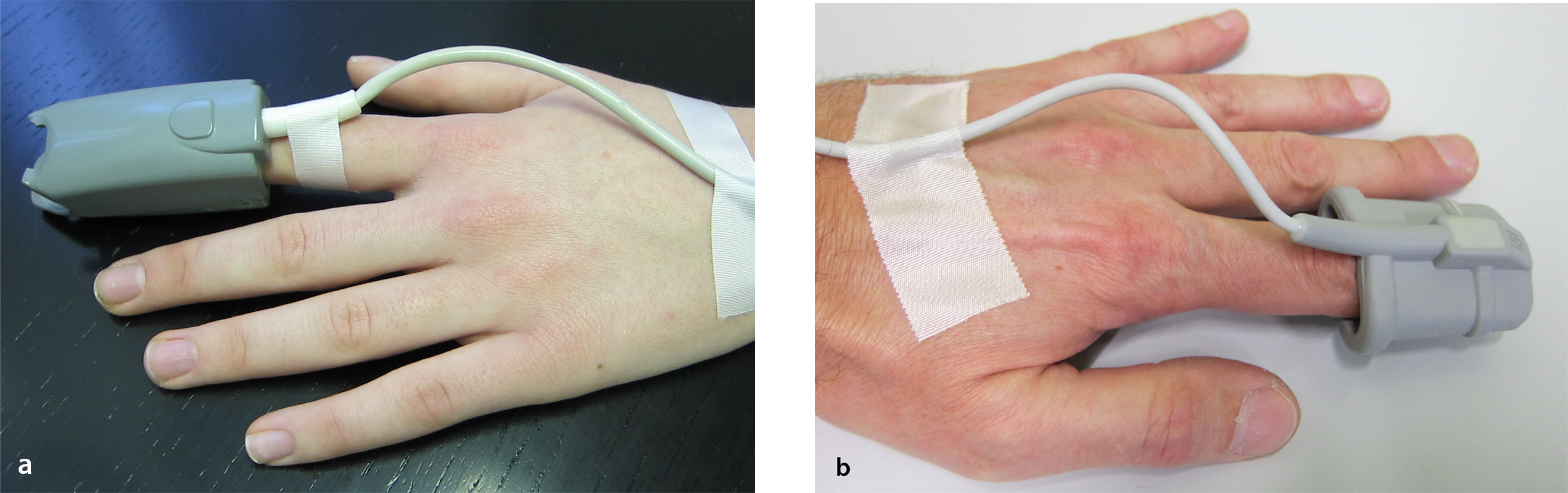 Die ambulante Polygraphie richtig eingesetzt | SpringerLink