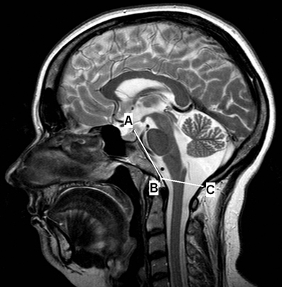 The Clivus | SpringerLink