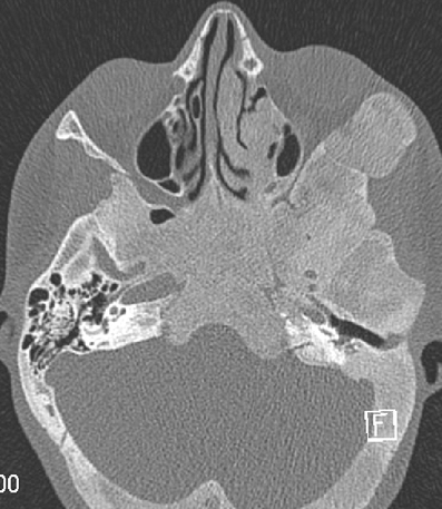 The Clivus | SpringerLink