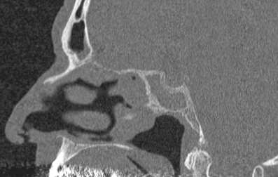 The Clivus | SpringerLink