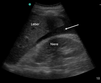 Strukturierte bettseitige Sonographie in der Intensivmedizin | SpringerLink
