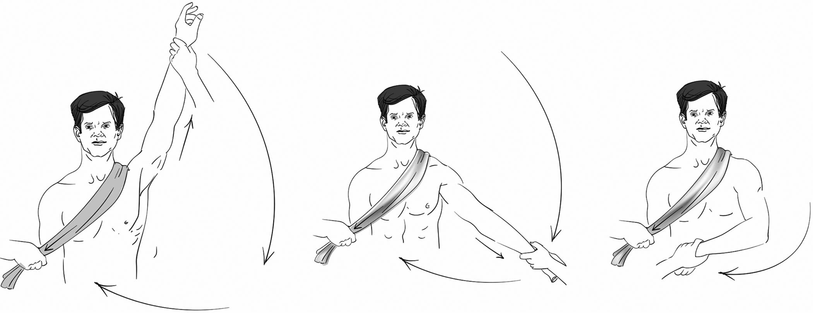 Traumatic inferior shoulder dislocation: a review of management and ...