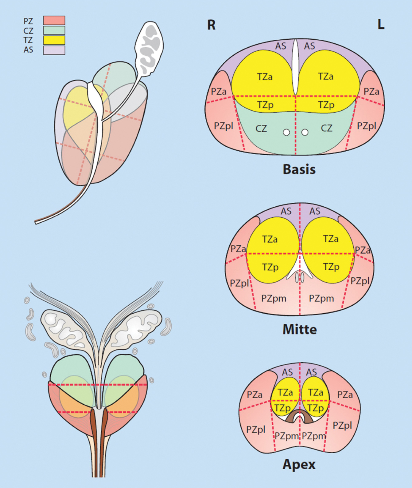 Was die neue PI-RADS™-Klassifikation für die Praxis bedeutet | SpringerLink