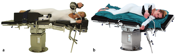 Lagerung des Patienten zur Operation | SpringerLink