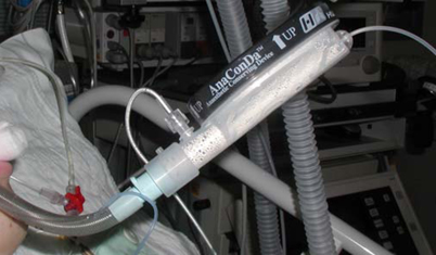 Sedierung mit volatilen Anästhetika auf der Intensivstation | SpringerLink